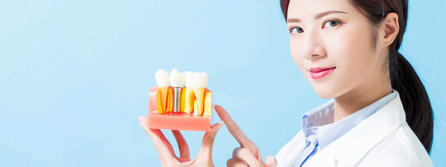 Dental Implants 101: Everything You Need to Know - Radiance Dental Clinic